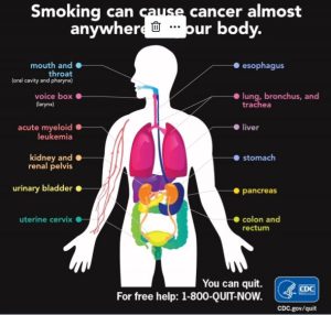 Tobacco infographic | Lake County General Health Department